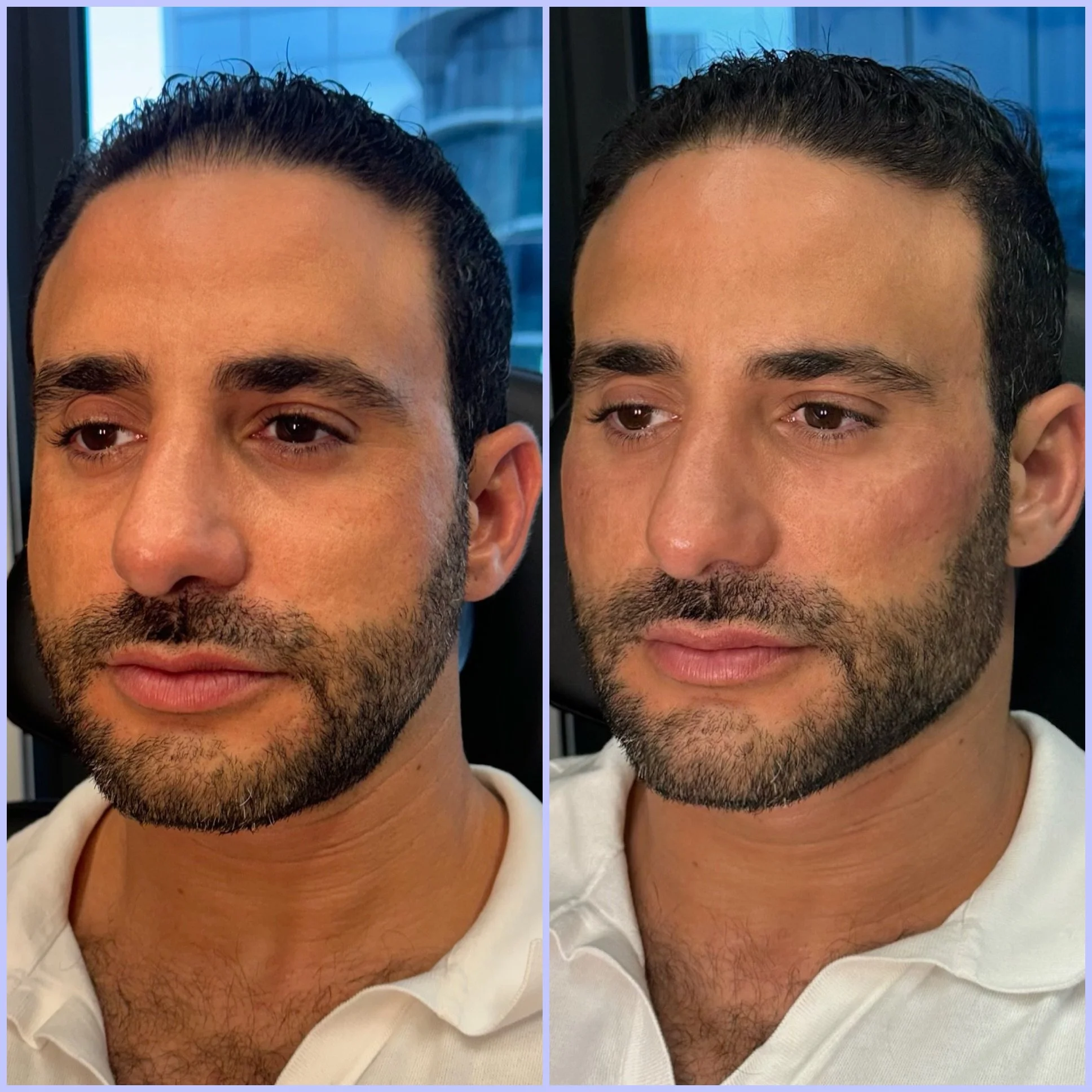 Randy Lindgren Aesthetic Rejuvenation