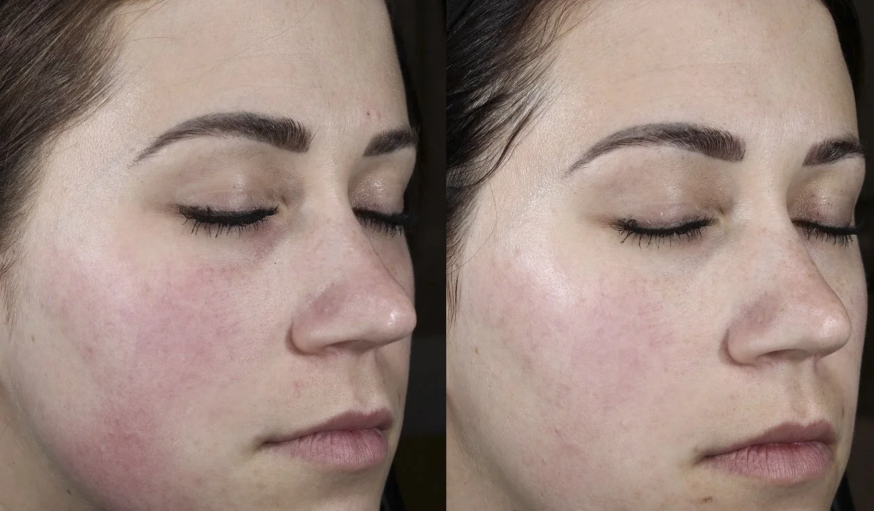 Plated Skin Science Before and After — ⬦ A-Class Aesthetics