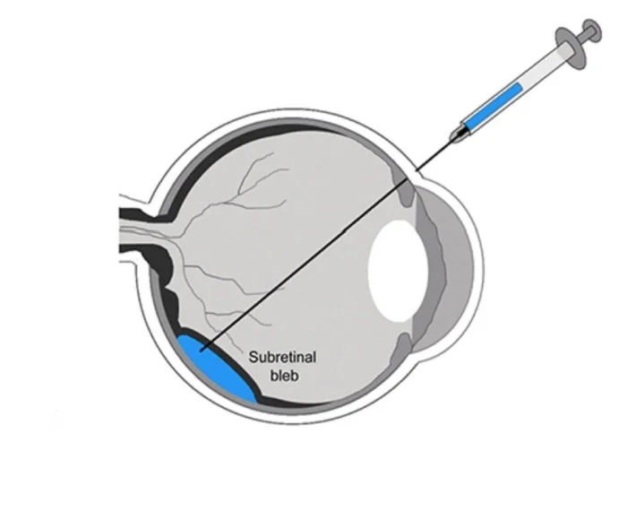 Our Treatment — Luxa Biotechnology, LLC