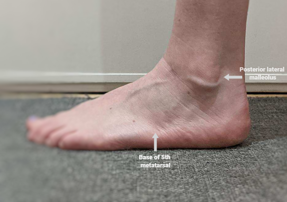 Lateral Ankle Sprain Rehab — Soccer Rehab