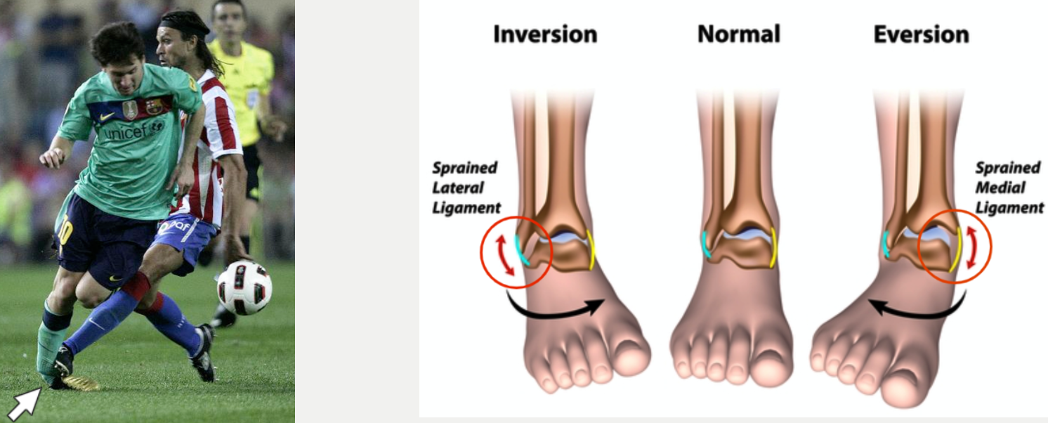 Lateral Ankle Sprain Rehab — Soccer Rehab
