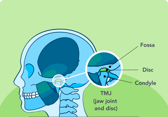 JawSpace - Award-winning TMD & TMJ self-care.