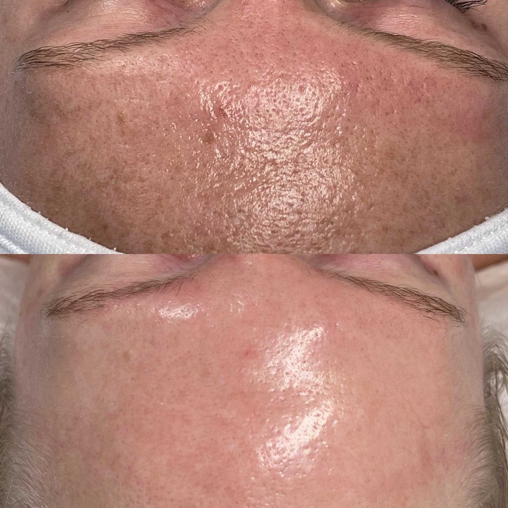 Real Results — The Skin Standard