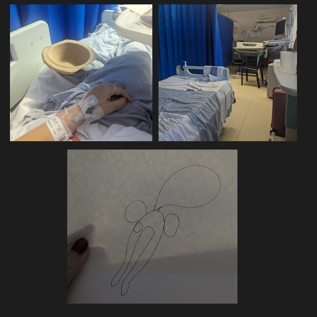 My experience with uterine fibroids | open myomectomy | NHS — East ...