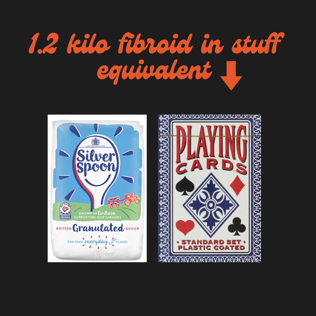 My experience with uterine fibroids | open myomectomy | NHS — East ...