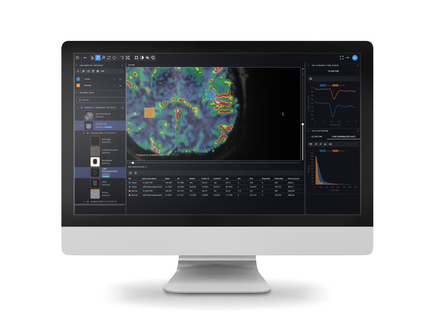 Perfusion — nordicMEDiVA