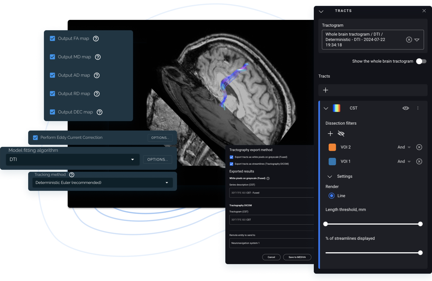 Diffusion and Tractography — nordicMEDiVA