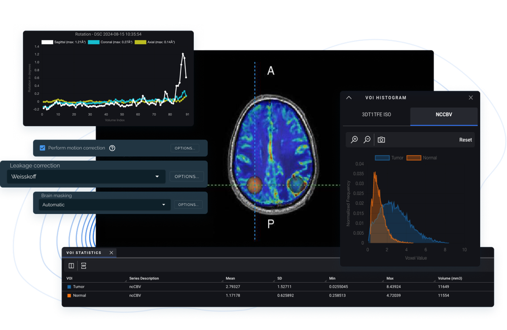 DSC Perfusion — nordicMEDiVA