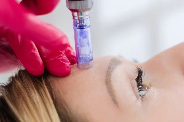 SQT Bio-microneedling Certificate - AIT Accredited — Beautorium ...