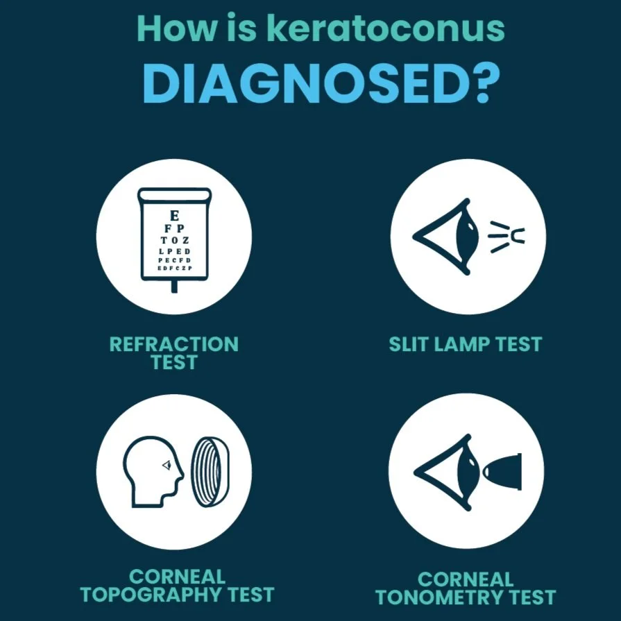 Keratoconus — TheiaNova
