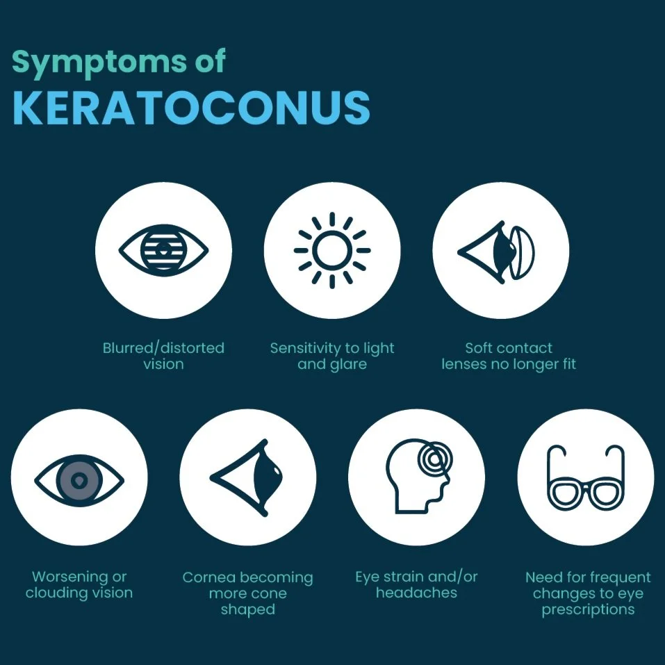 Keratoconus — TheiaNova