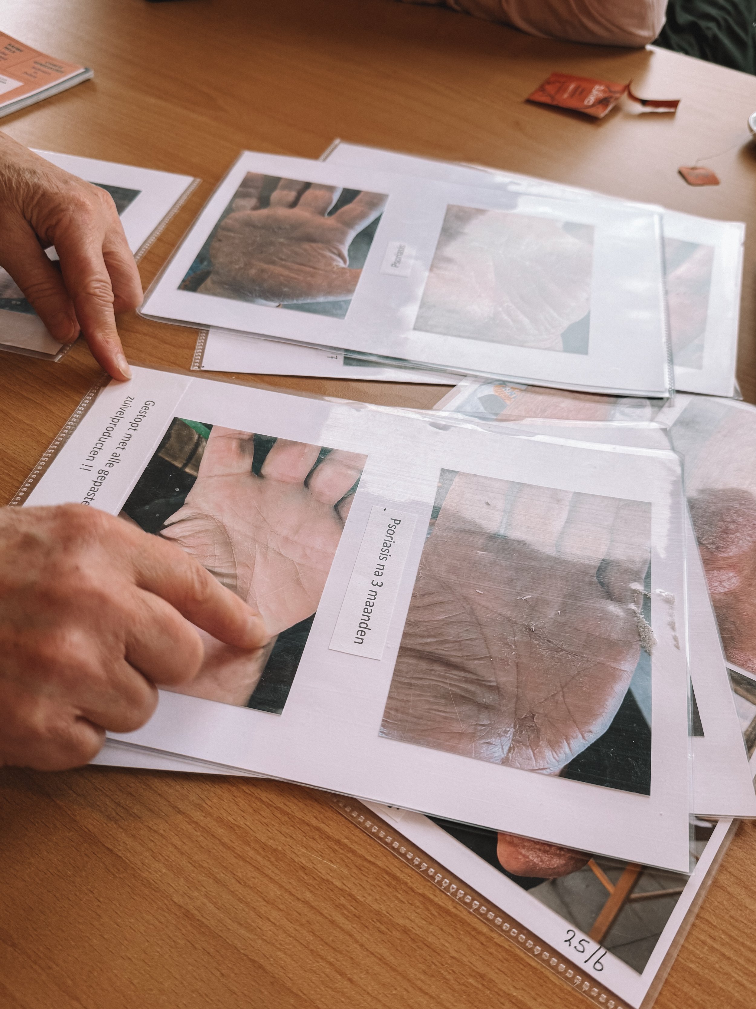 Waarom zou (gefermenteerde) Rauwe Zuivel voor jou kunnen werken? — Beau ...