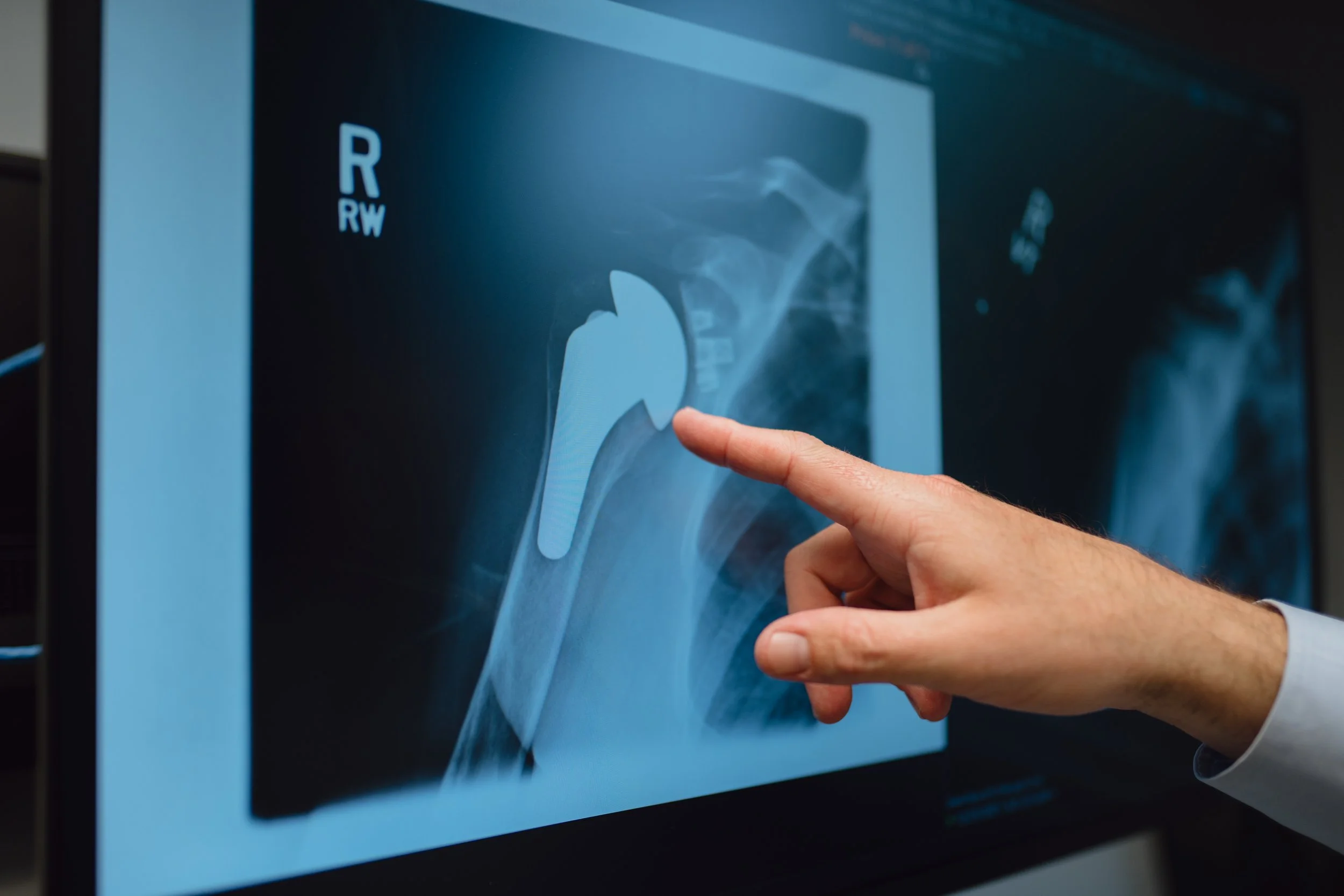 Dr. John Hinchey — Ortho San Antonio