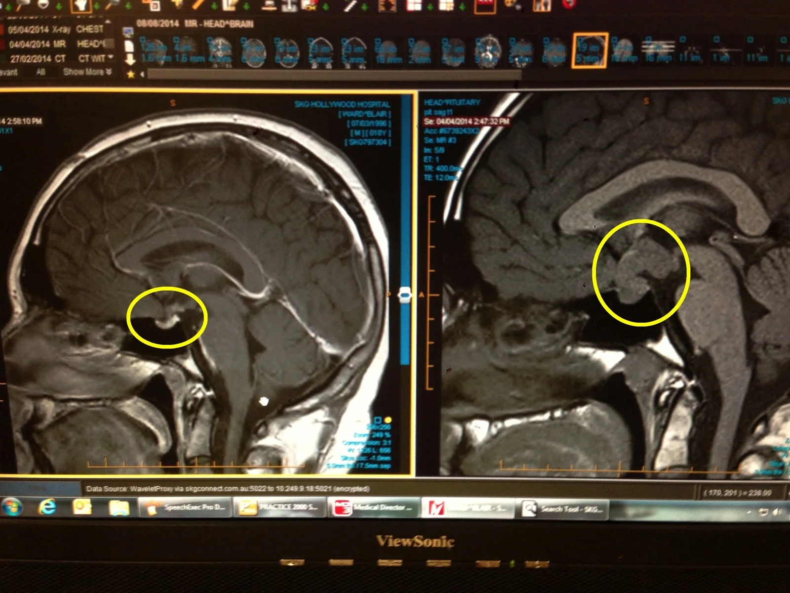 BBR Trainer Profile - Blair Ward — BBR