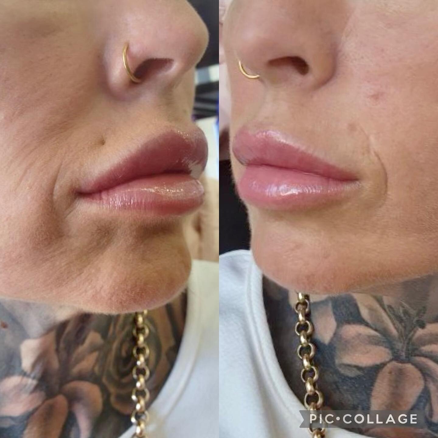 Contact — Skin Haven Aesthetics