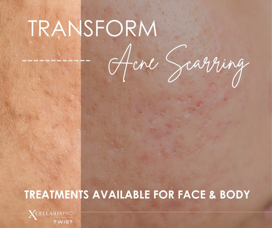 Transformative Aesthetics: Discover Specialized Skin Services at Skin ...