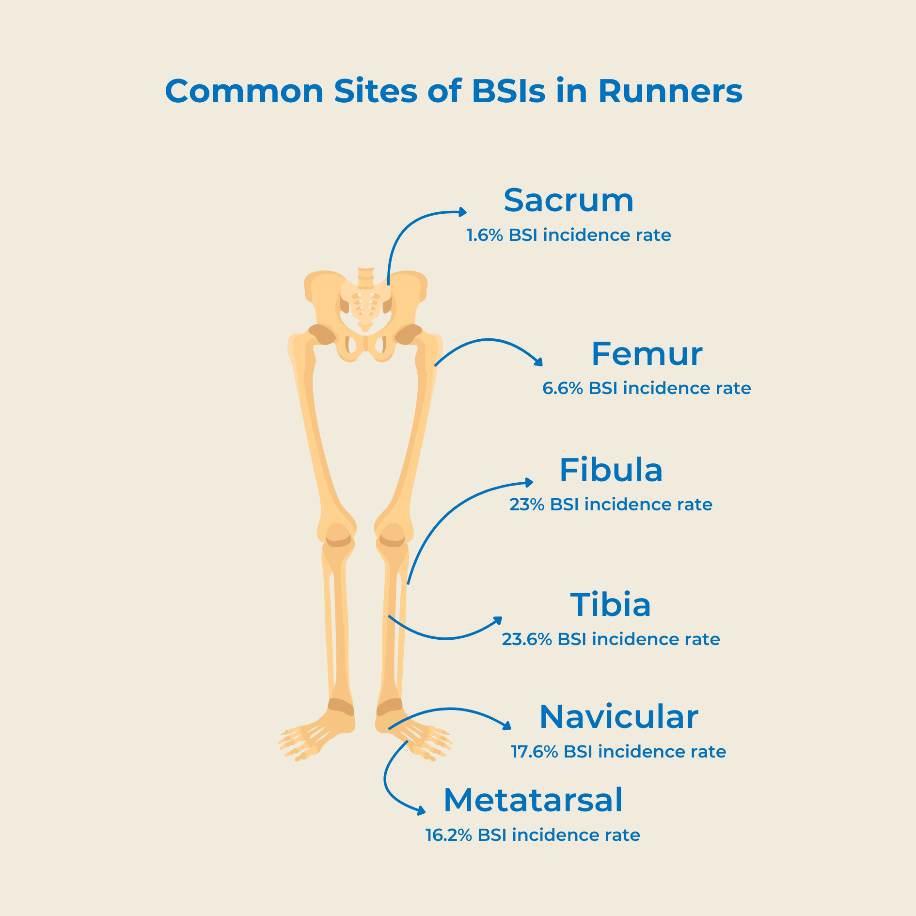 Stress Fractures and Bone Stress Injuries in Runners: What You Need to ...