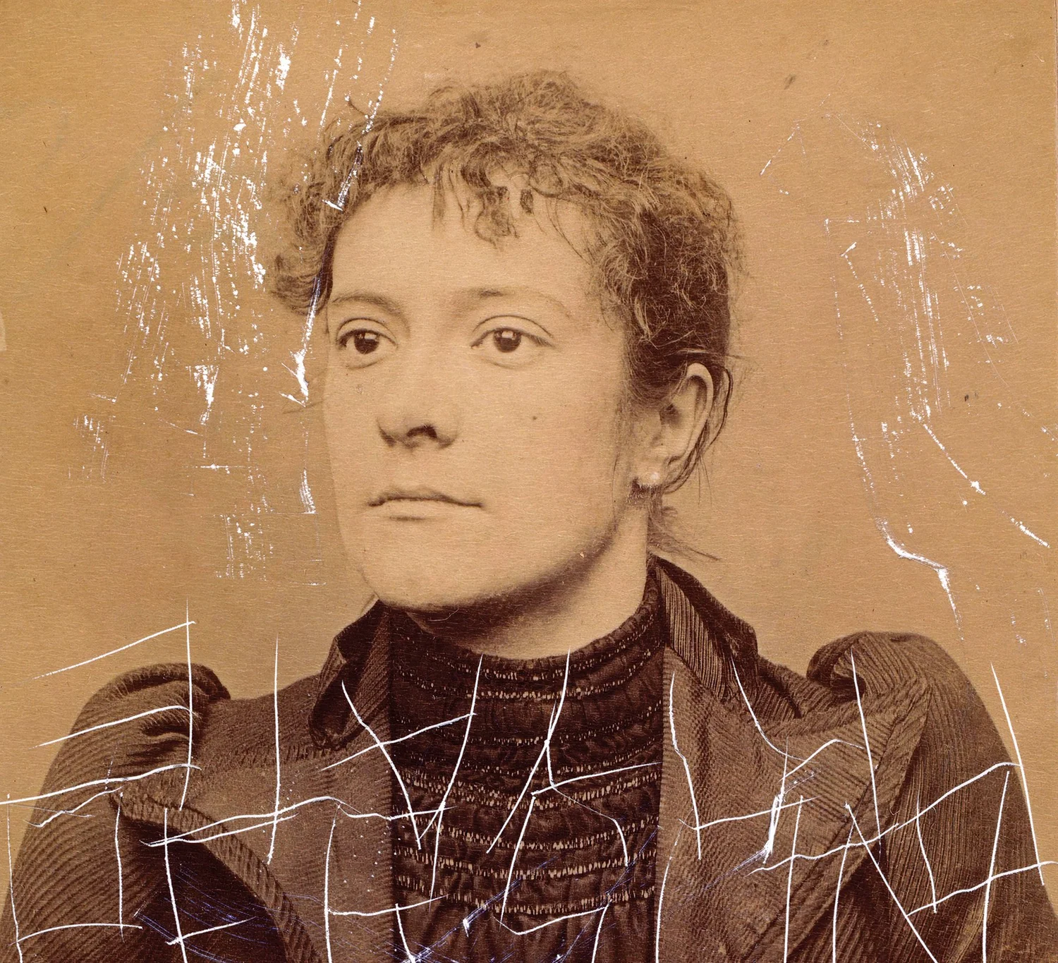 Secondary Gain 004 — Parapraxis