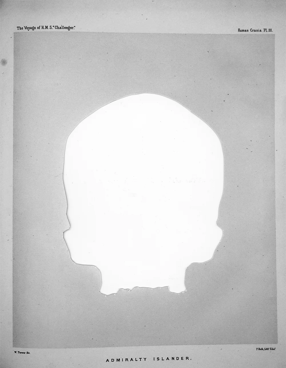 The Windward View — Parapraxis