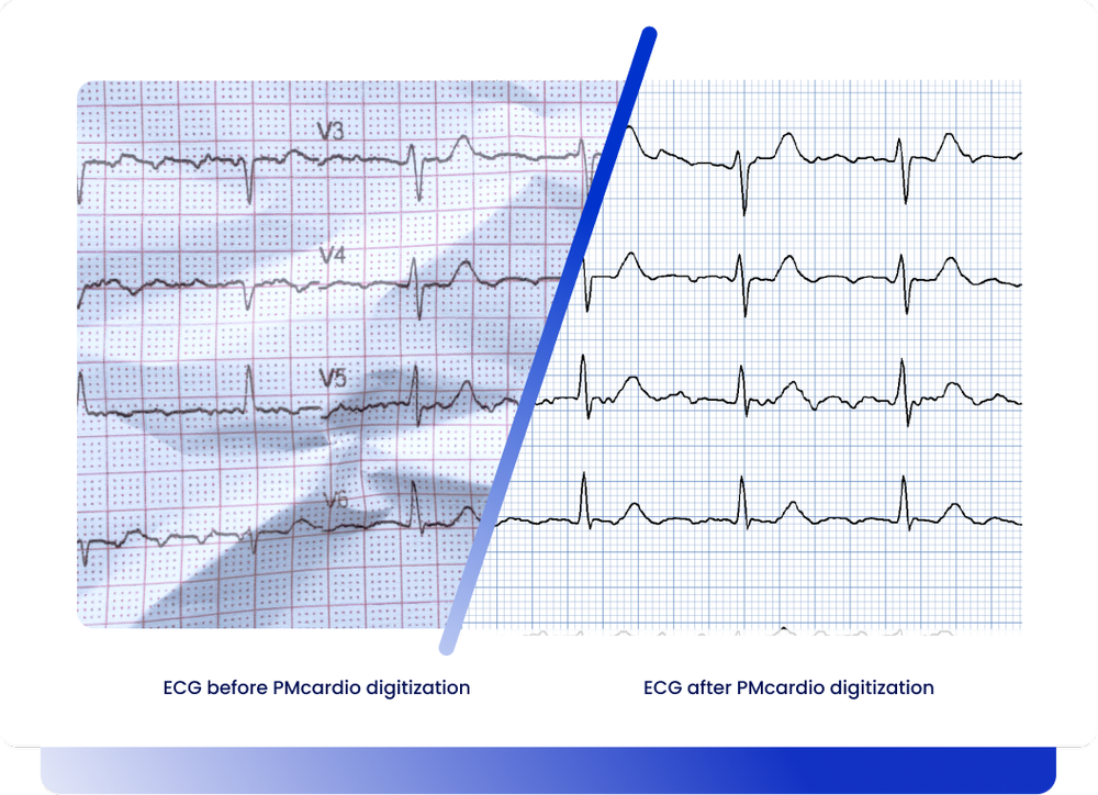 PMcardio Digitize — Powerful Medical