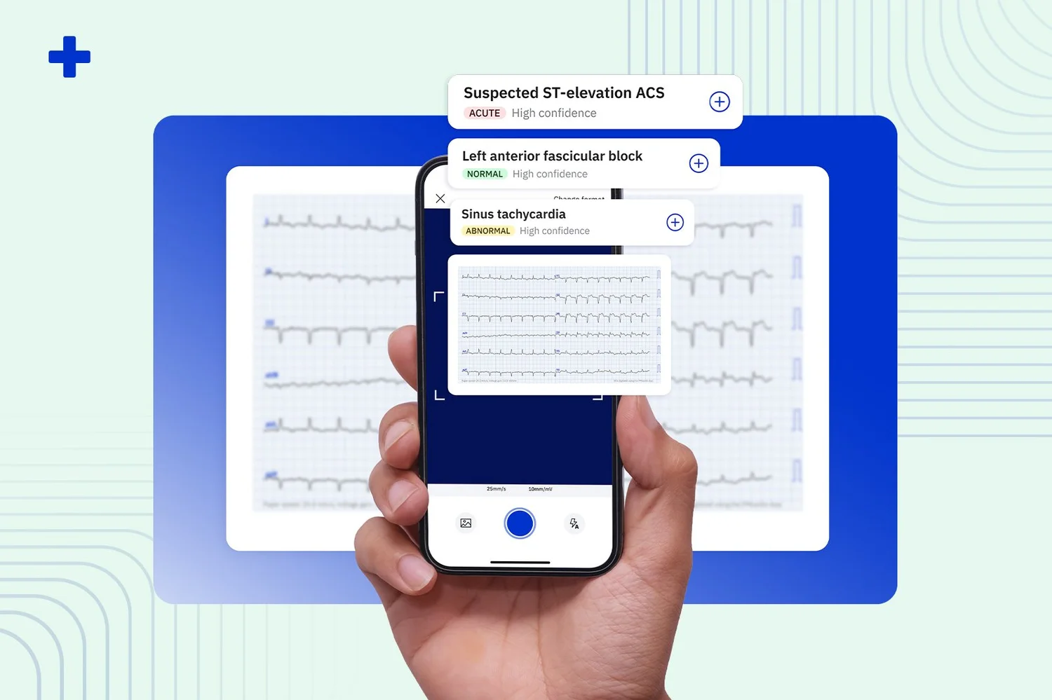 How is AI transforming ECG interpretation? — Powerful Medical