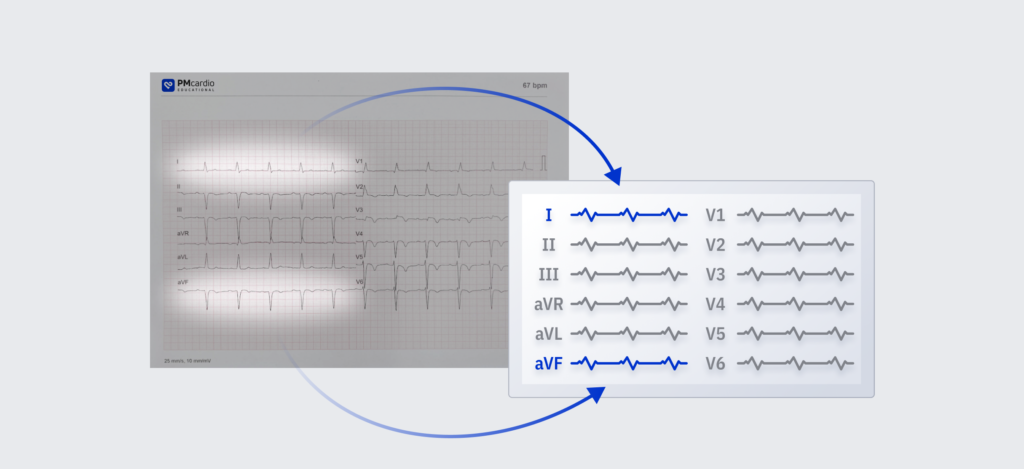 Get your first ECG scan right! — Powerful Medical