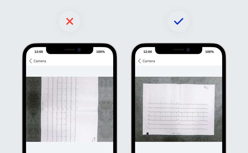 Get your first ECG scan right! — Powerful Medical