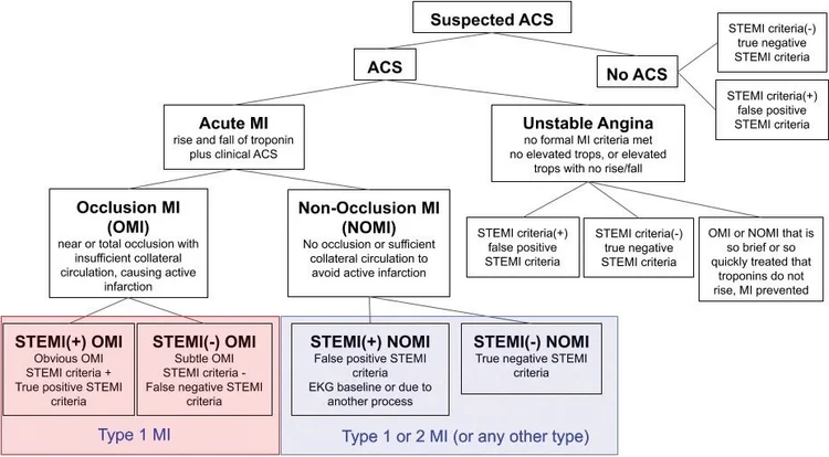Occlusion Myocardial Infarction (OMI): Importance, Recognition, and ...