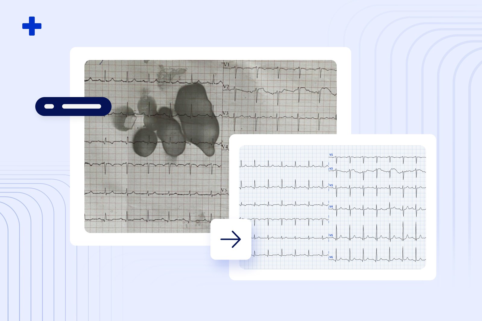 How to improve the quality of an ECG instantly (with examples ...