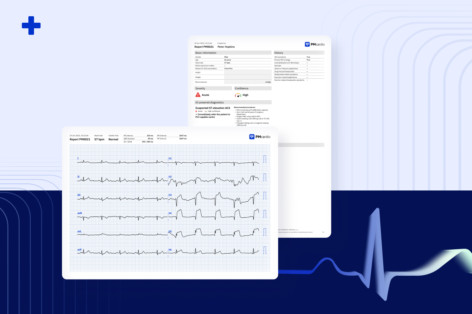 Introducing: PMcardio ECG diagnostic reports — Powerful Medical
