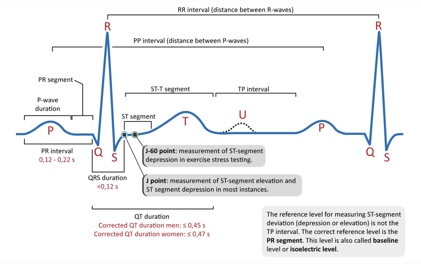 Ecg Interpretation
