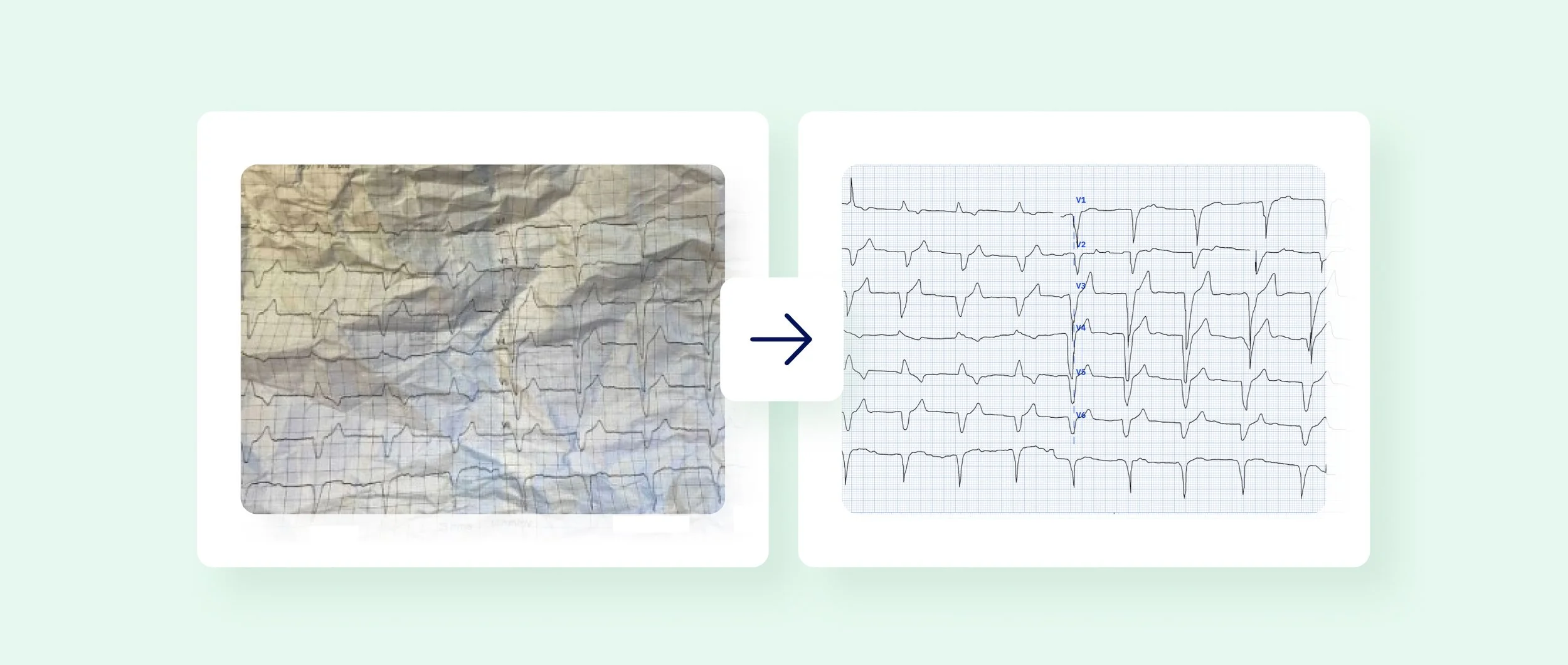 A write-up from Dr Robert Herman’s talk on AI-Augmented ECG ...