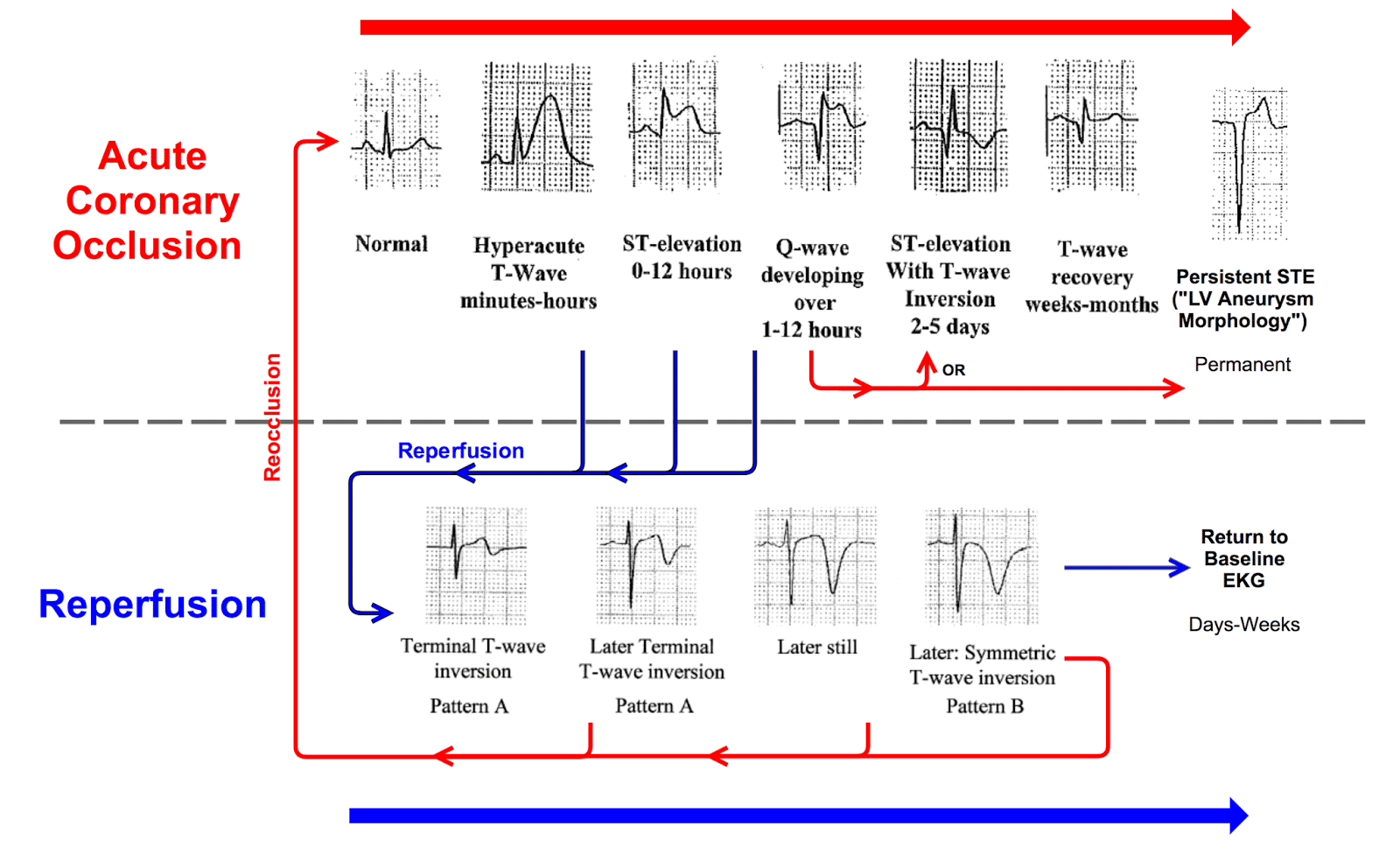 ACS Guidelines 2023: New ESC Update — Powerful Medical