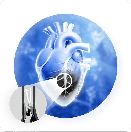 PMcardio: AI-Powered ECG Interpretation (by Powerful Medical)
