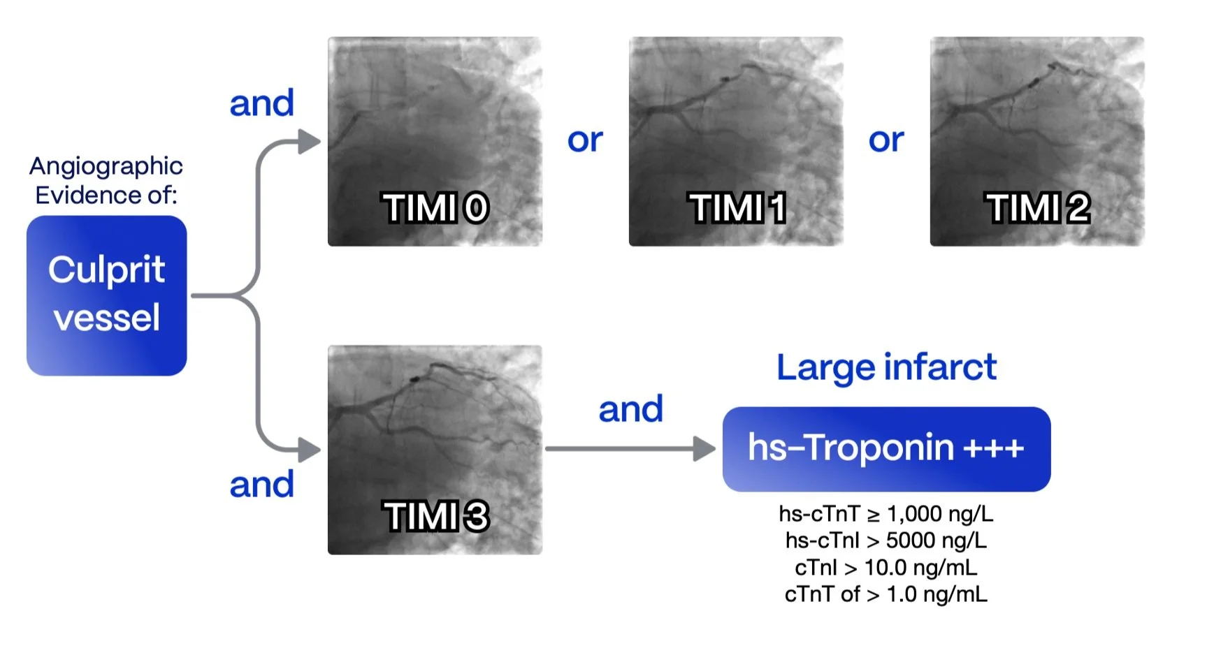 Occlusion Myocardial Infarction (OMI): Importance, Recognition, and ...