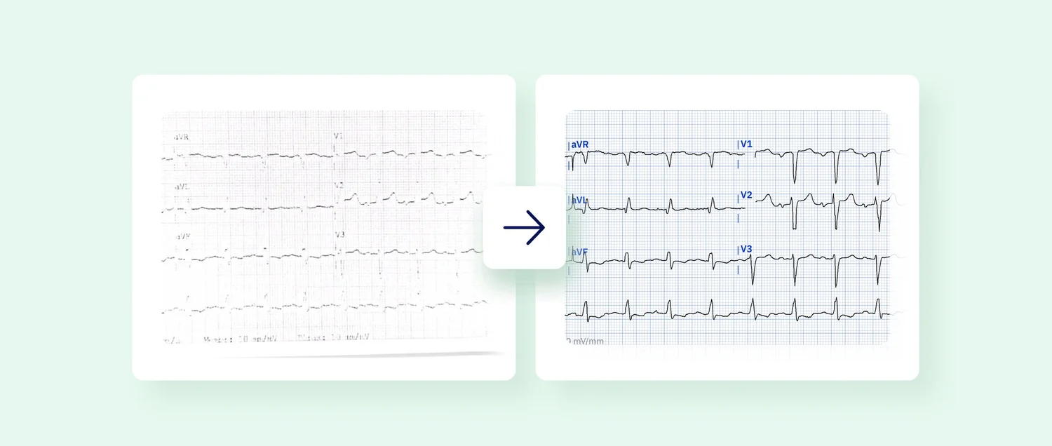 How to improve the quality of an ECG instantly (with examples ...