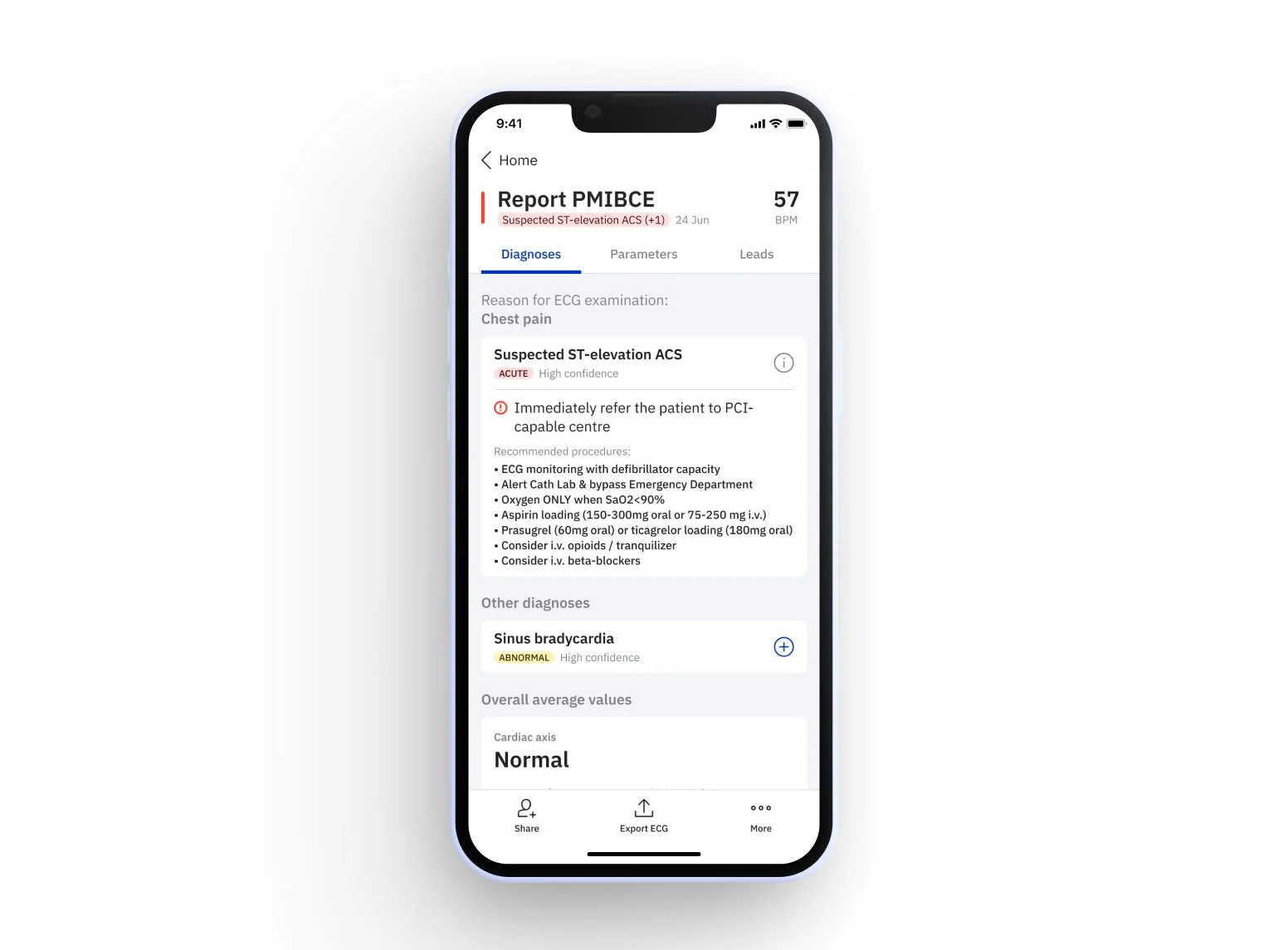 Introducing: PMcardio ECG diagnostic reports — Powerful Medical