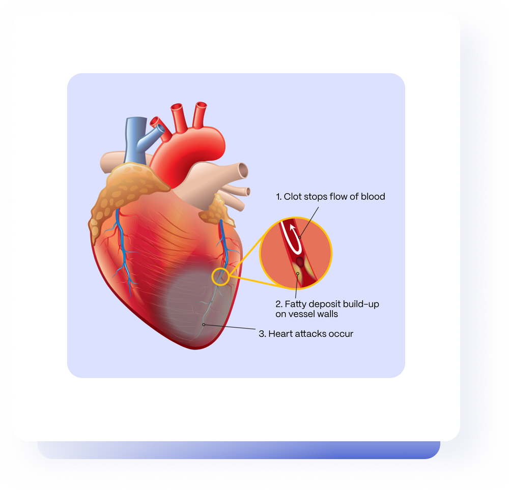 PMcardio: AI-Powered ECG Interpretation (by Powerful Medical)