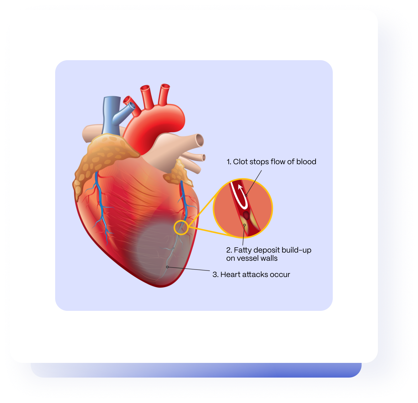 PMcardio: AI-Powered ECG Interpretation (by Powerful Medical)