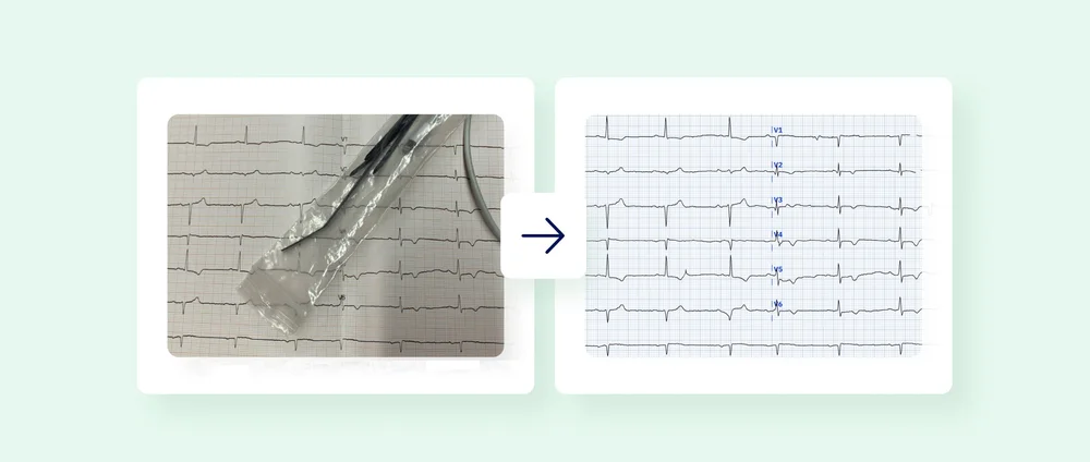 How to improve the quality of an ECG instantly (with examples ...