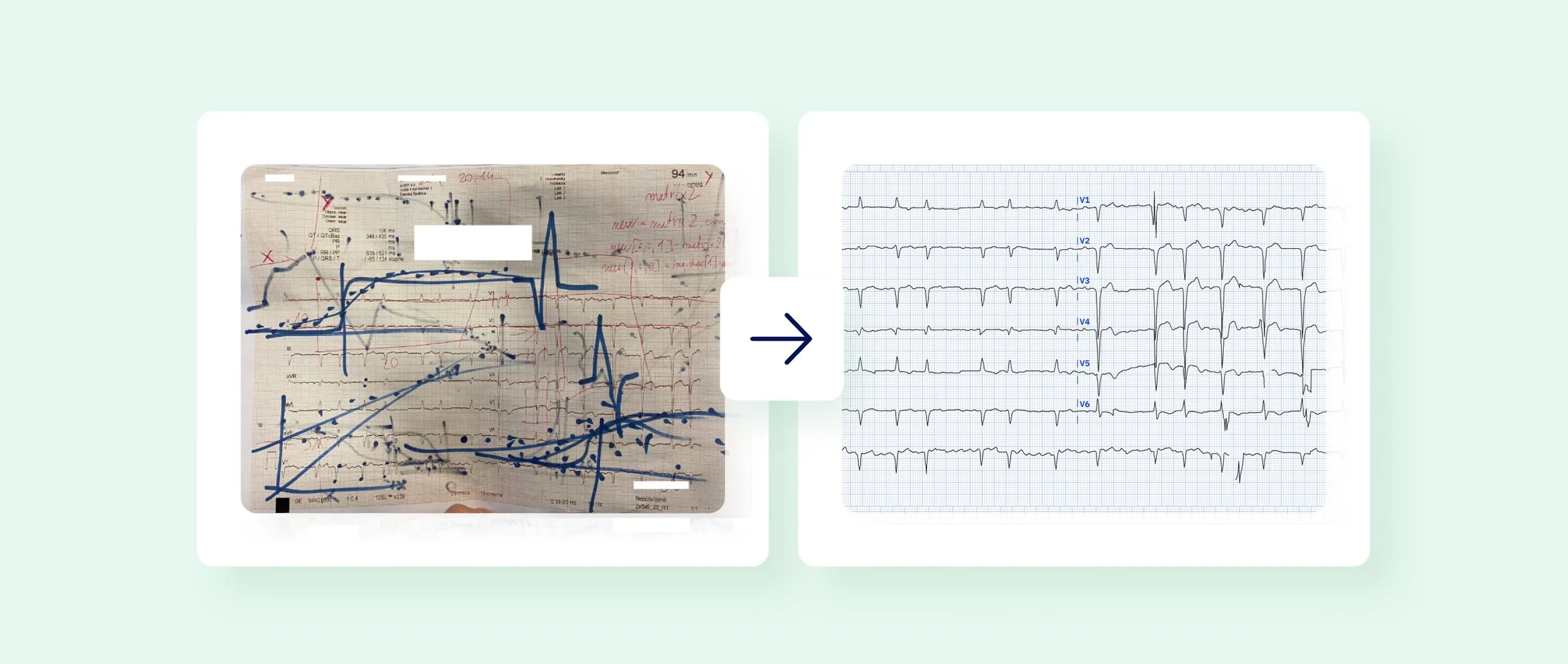 How to improve the quality of an ECG instantly (with examples ...