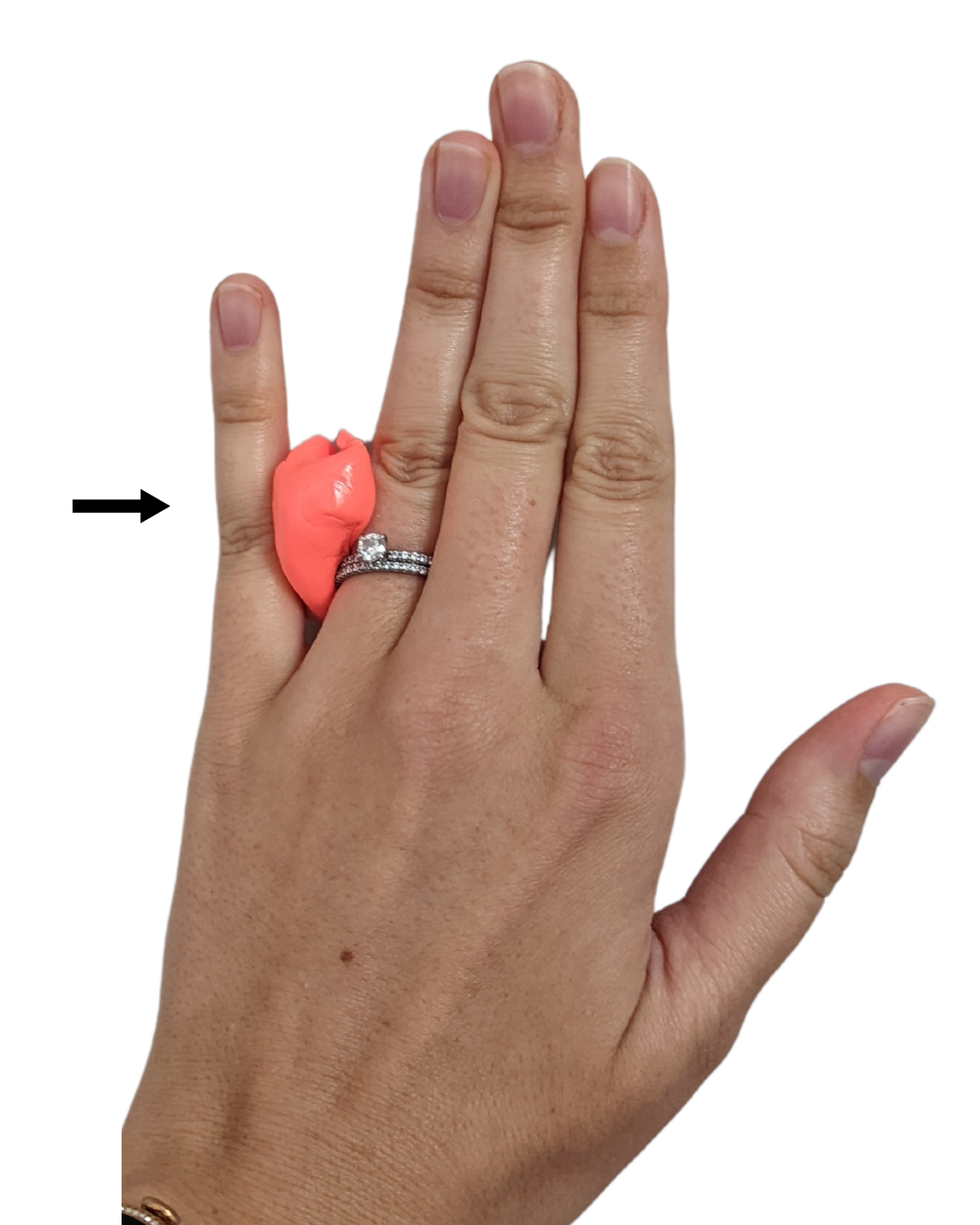 Does your pinky side ache? Here’s why (and what you can do!) — Hand ...