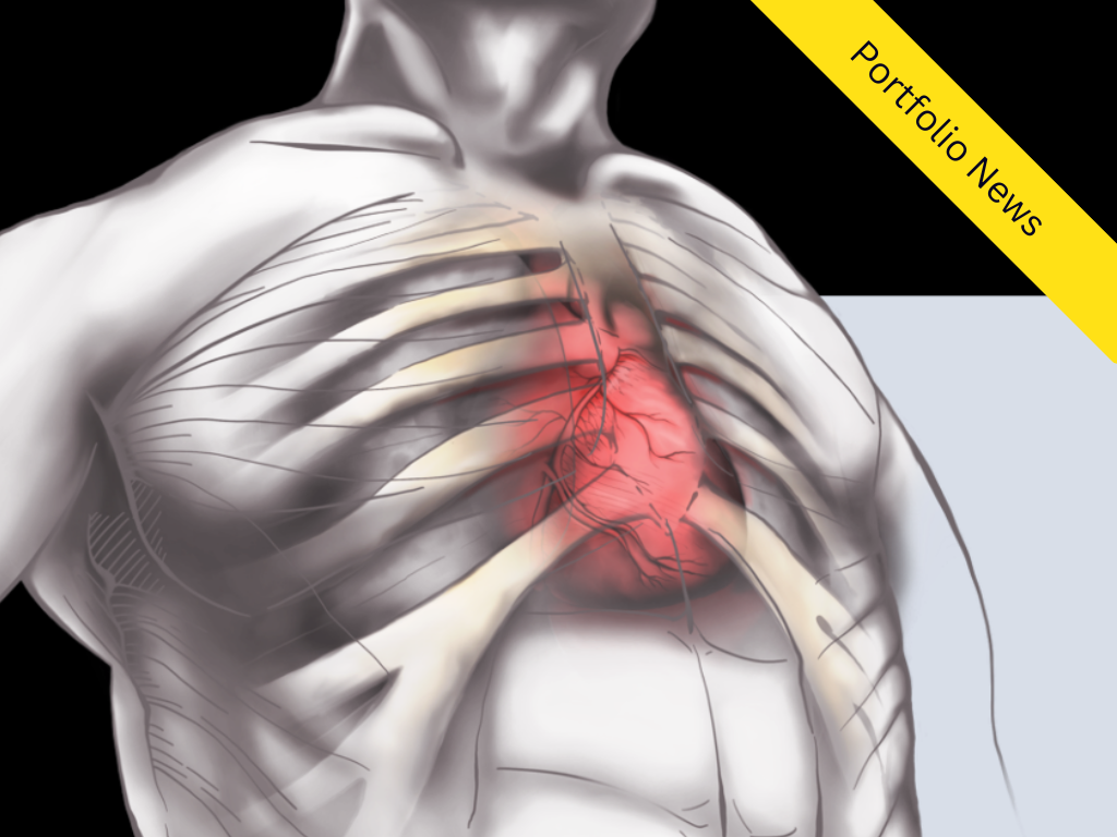 Insights — Pace Ventures