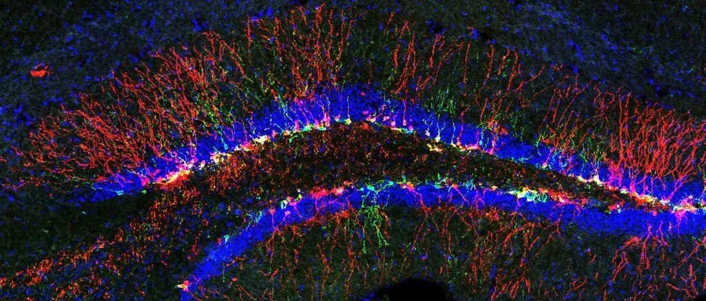 Research Memory And Cognition Lab
