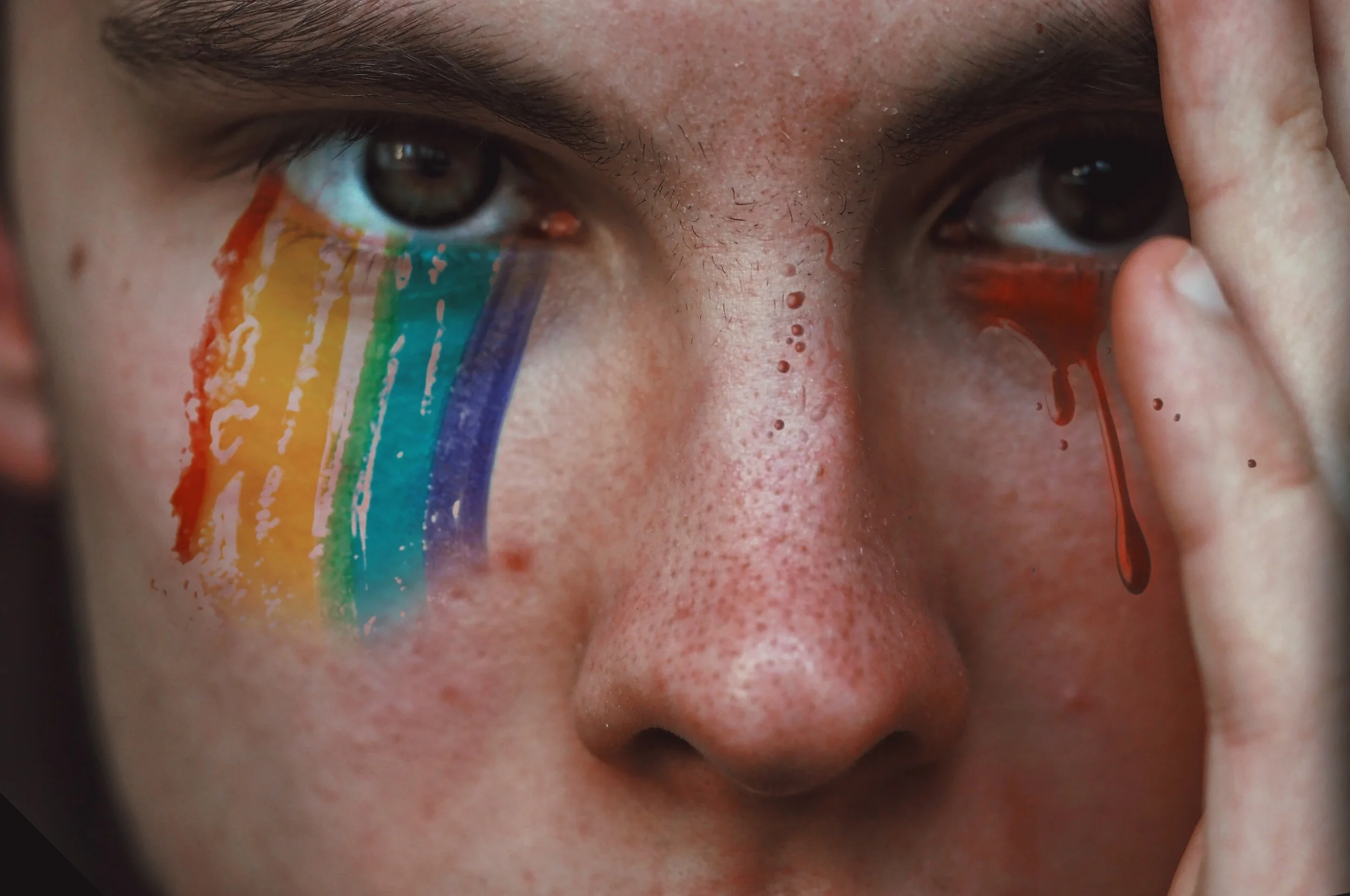 Overcoming Internalized Homophobia and Self-Acceptance
