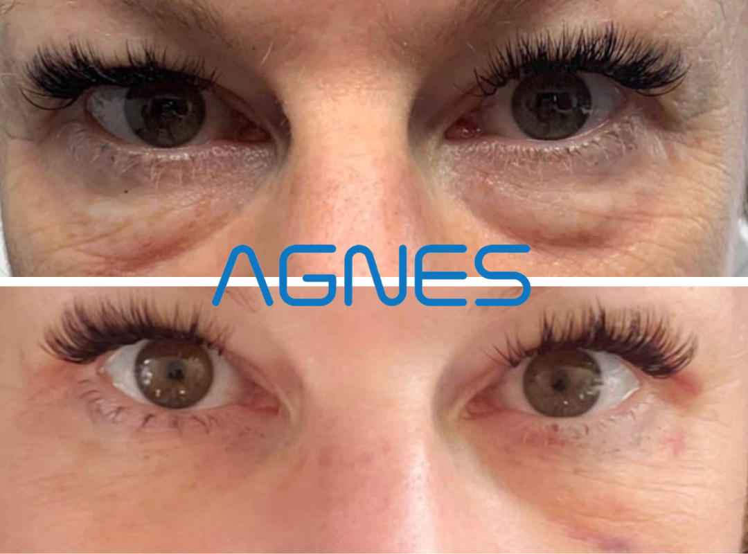 Face & Body Contouring for Sculpted Results | Infinity Laser Med Spa ...