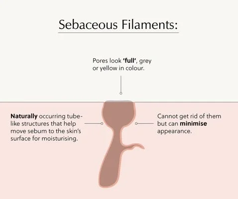 What's the Difference Between Blackheads and Sebaceous Filaments? — Fresh Face Beauty