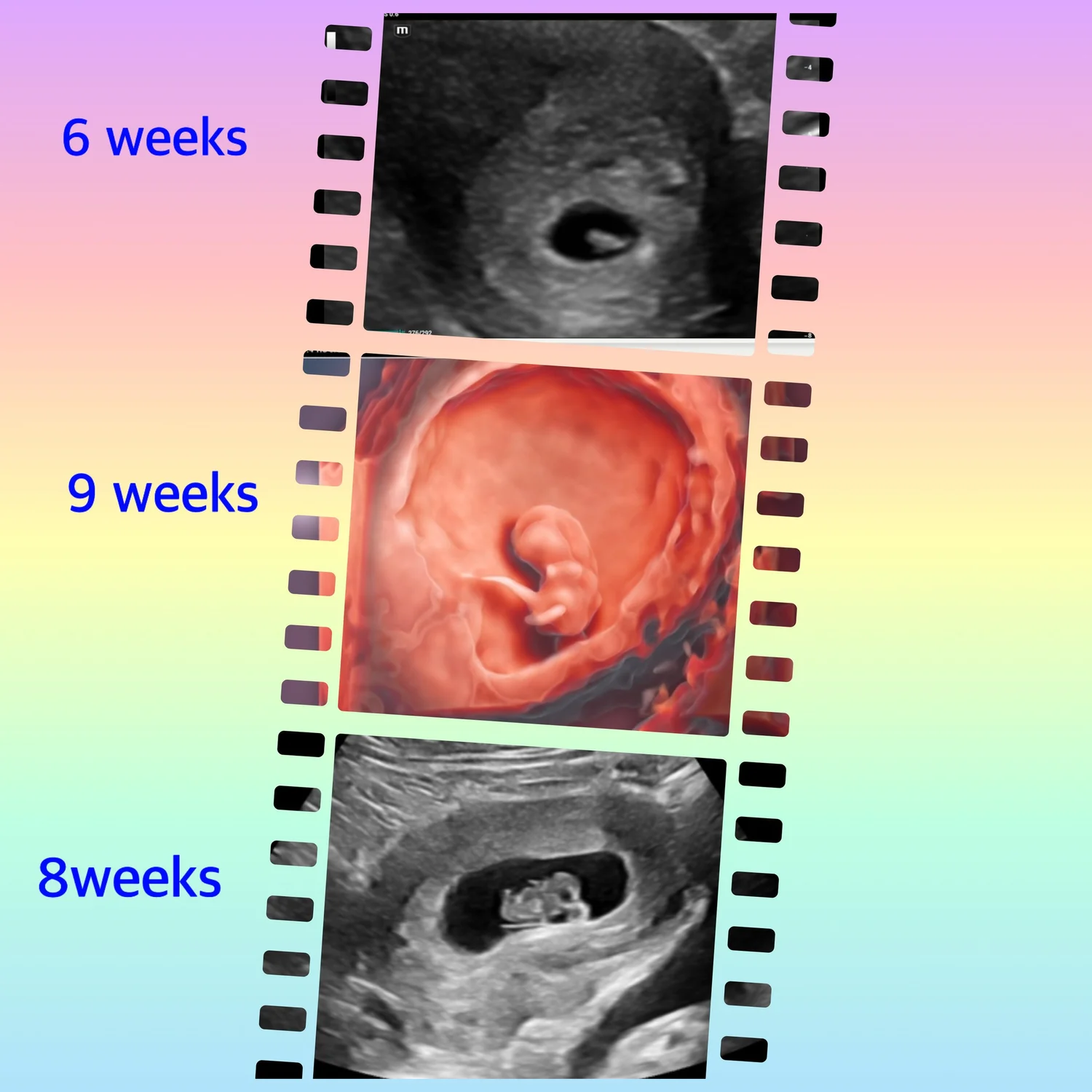 Ultrasound 3D 4D 5D HD baby ultrasound imaging. Gender Ultrasound Sonogram. Bebe de Ultrasonido ...