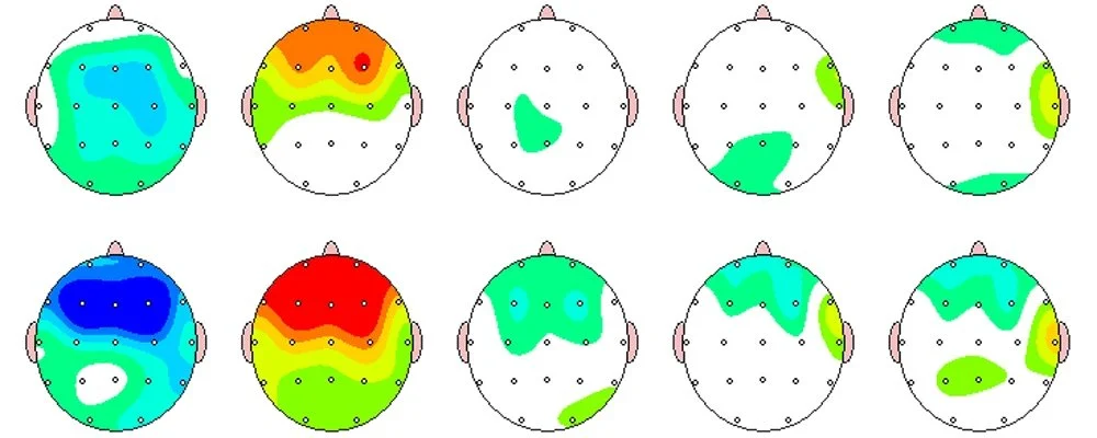 Advanced Brain Centers of VA