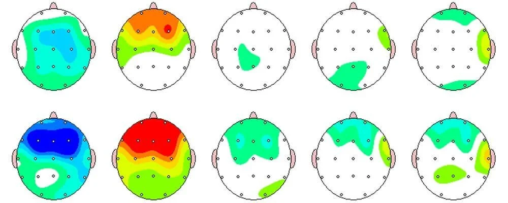Enhance and Experience Peak Brain Performance — Advanced Brain Centers ...